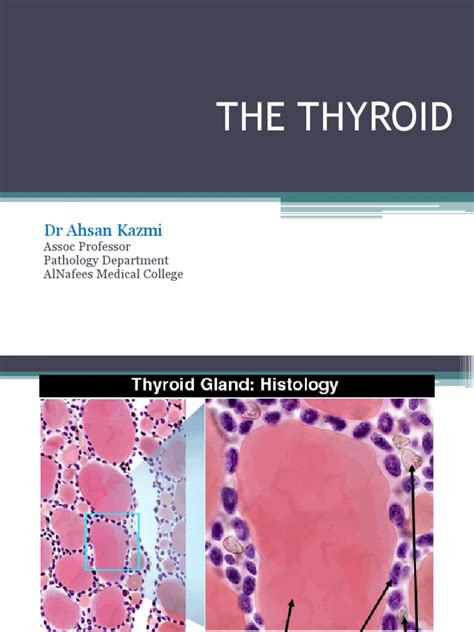 Thyroid Gland Pathology Overview Pdf Thyroid Hypothyroidism