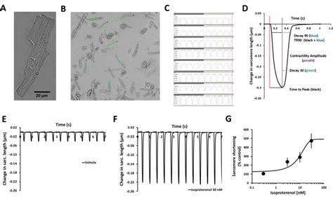 Measurement Of Heart Contractility In Isolated Adult Human Primary
