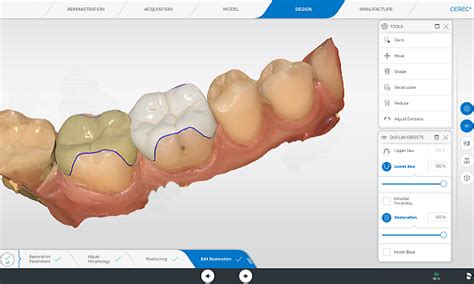 Software Cerec Dentsply Sirona México