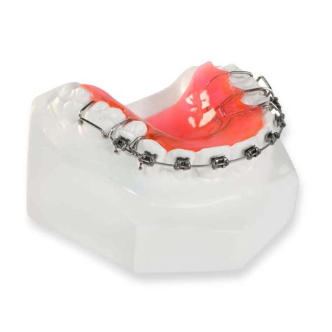Fake Braces Realistic Removable Braces For Photoshoots And Film