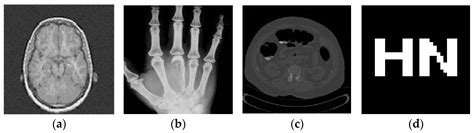 Electronics Free Full Text Robust Zero Watermarking Algorithm For Medical Images Based On