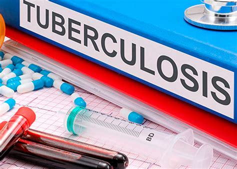 Nuevo Tratamiento Revoluciona La Lucha Contra La Tuberculosis Resistente Tn8 Tv