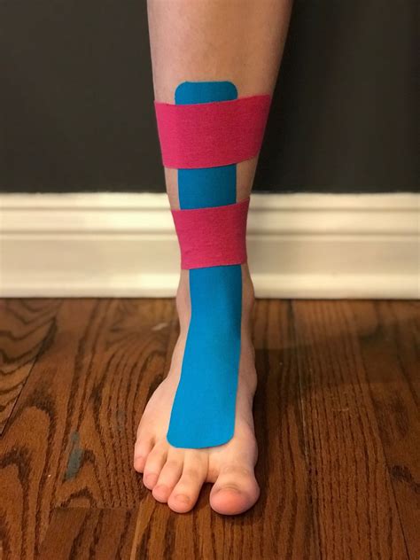Eversion Ankle Sprain Kt Tape Immediate Effect Of Kinesiology Tape On