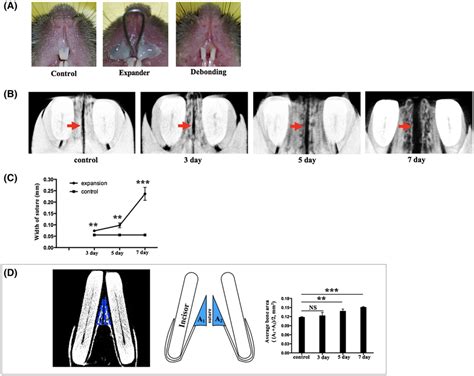 The Maxillary Sutures Of Mouse Were Expanded After Force Application