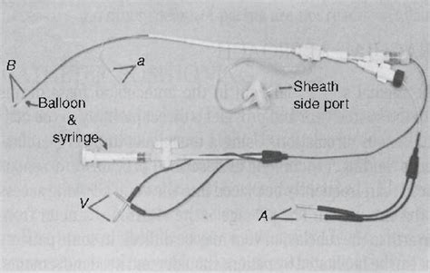 Temporary Cardiac Pacemakers Anesthesia Key