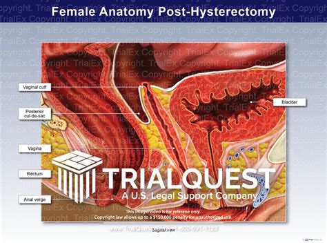Hysterectomy Anatomy
