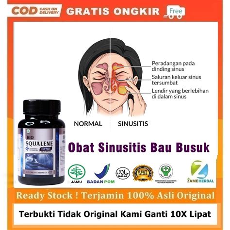 Jual Obat Sinusitis Bau Busuk Penghilang Ingus Berbau Tidak Sedap