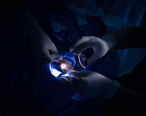 ¿qué Es La Oftalmoscopia Indirecta Somos Retina Y Mácula Consultores