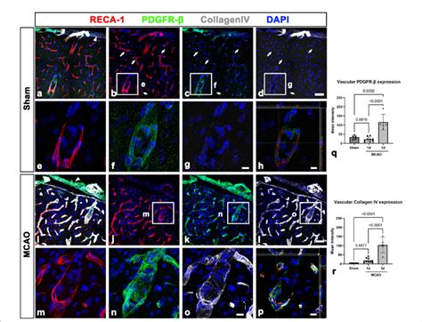 Pdgfr β Expression Profiles And Their Spatial Relationship With