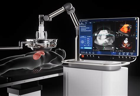 Exams And Procedures Histotripsy Johns Hopkins Radiology