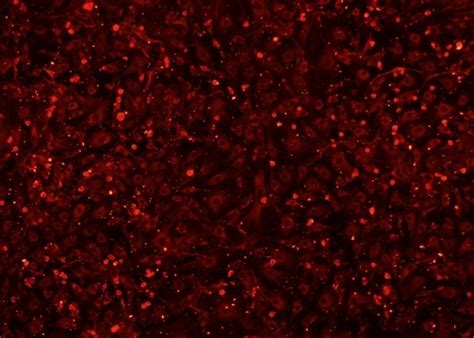 小鼠肺血管内皮细胞如何参与血管生成和血管重构？ 无锡欣润生物科技有限公司