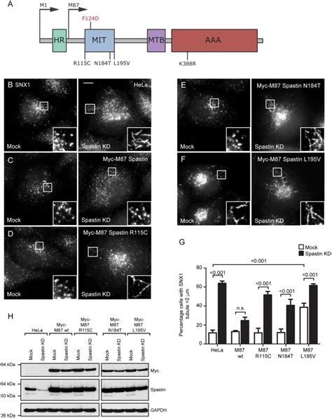 Spastin Mit Domain Disease Associated Mutations Disrupt Lysosomal