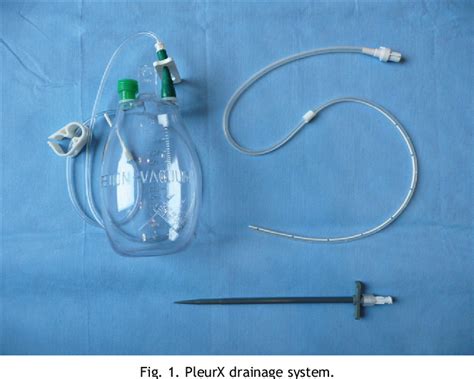 Figure 1 From Malignant Pleural Effusion In The Presence Of Trapped