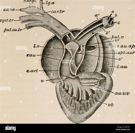 Conus Arteriosus Heart
