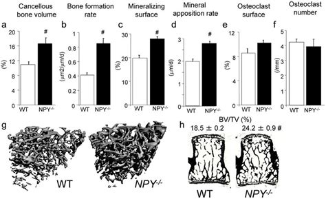 Greater Cancellous Bone Volume And Formation In Npy 22 Mice Download Scientific Diagram