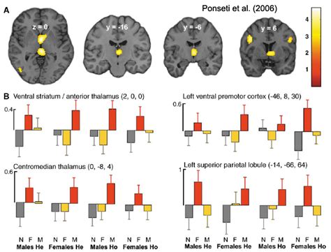 The Neurocritic An Endophenotype For Sexual Orientation
