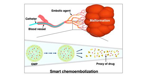 Monodisperse Microshell Structured Gelatin Microparticles For Temporary