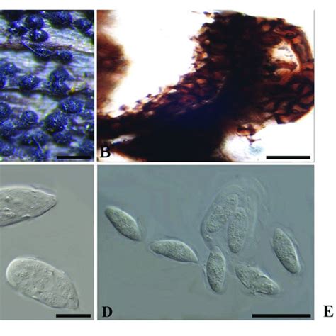 Botryosphaeria Mirabile G 00266251 Holotype Ab Fruiting Bodies
