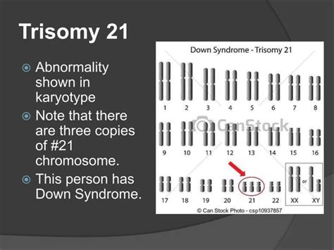 Karyotype Andidiogram Pptx Genetics Science