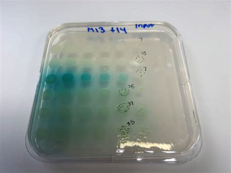 Bacterial Battle Tackling Pseudomonas Aeruginosa A Key Threat In