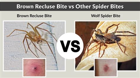 What Does A Brown Recluse Spider Look Like