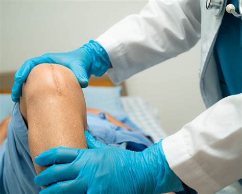 Why Patient Centred Care Enhances Total Knee Replacement Tops