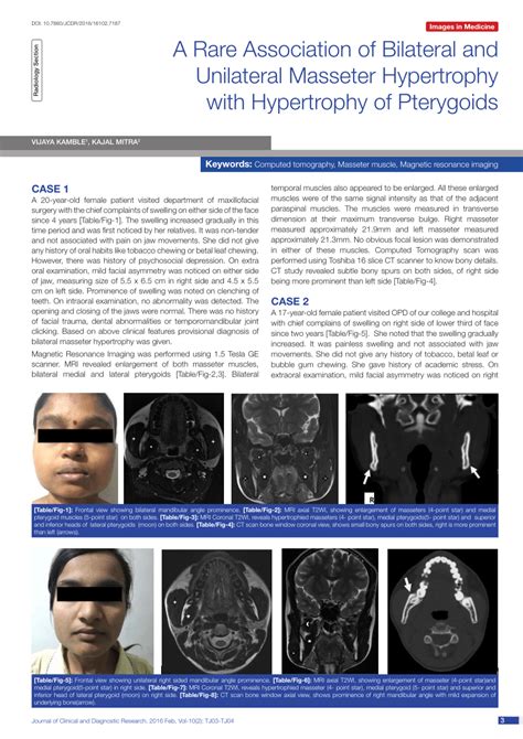 Pdf A Rare Association Of Bilateral And Unilateral Masseter