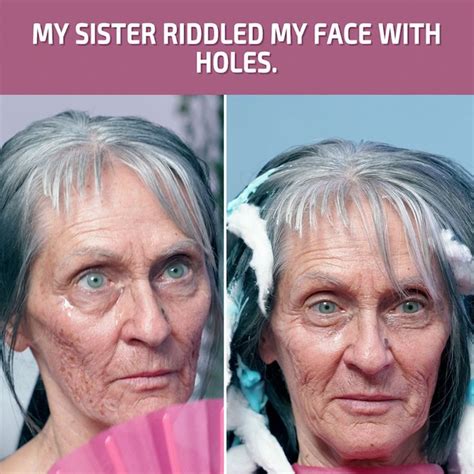 My Sister Turned My Face Into A Sieve Face The Sister Ruined Her