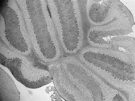 Why Do I Observe Uneven Staining Patterns With Calbindin Antibody On Mouse Tissue Researchgate