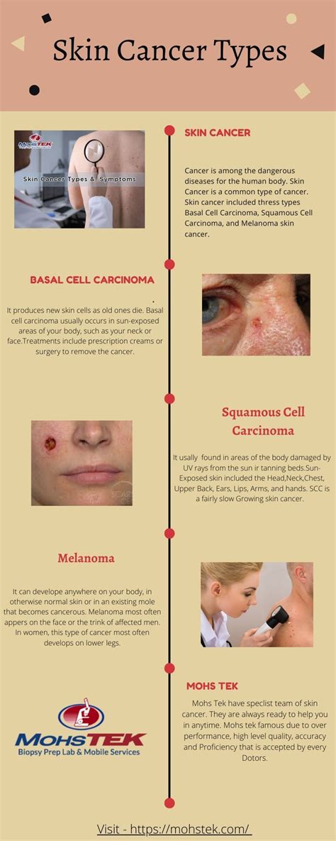 Basal Cell Artofit