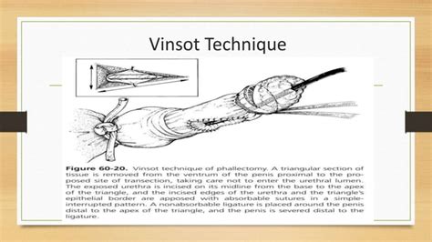 Phallectomy Pptx Surgery Medical Health