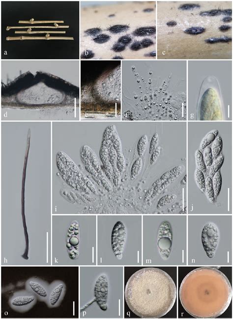 Figure 2 From Arthrinium Setostromum Apiosporaceae Xylariales A