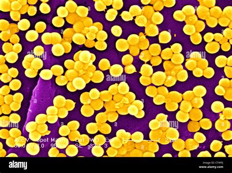 Staph Under Microscope