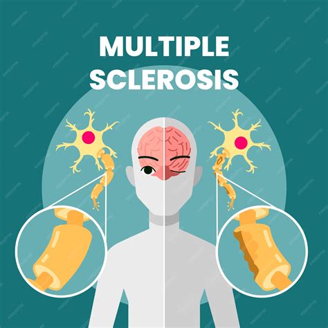 Premium Vector Hand Drawn Flat Design Multiple Sclerosis Illustration