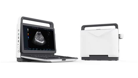 Medical Equipment Full Digital Portable Mobile Echocardiography Cardiac