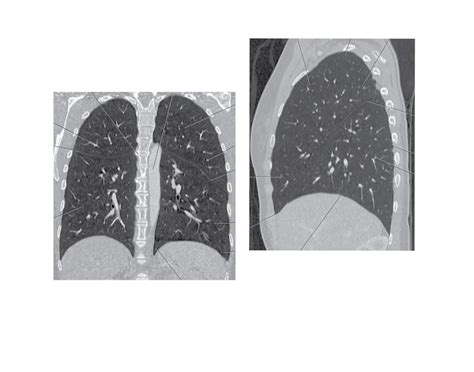 Midterm Thoracic 1 — Printable Worksheet
