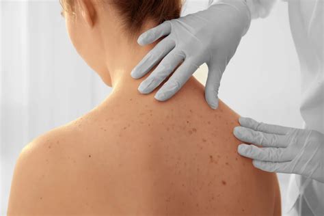 Conditions Treated Dermatology Services In Brookfield Wi