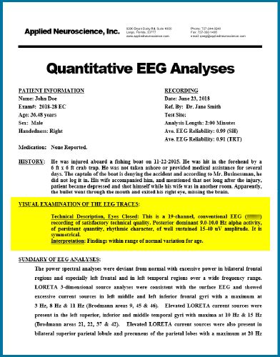Normal Eeg Report Sample Mapasgmaes