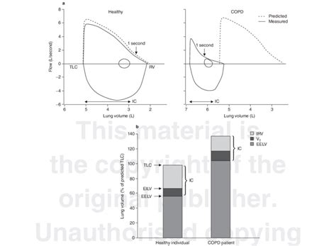 A Maximal Expiratory Large Outer Loops Lines And Tidal Small Inner