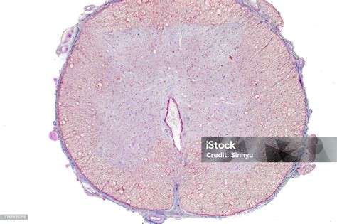 Motor Neuron Spinal Cord Nerve Fibres And Nerve Cells Under The