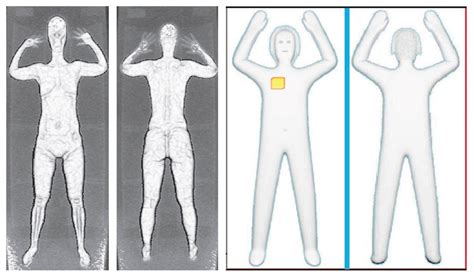 Farewell To ‘naked Airport Scanners Including 14 At Sea Tac