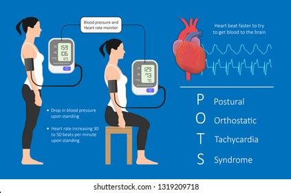 Orthostatic Bp Steps What Is Orthostatic Hypotension Postural