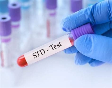 Cheap Std Test Singapore