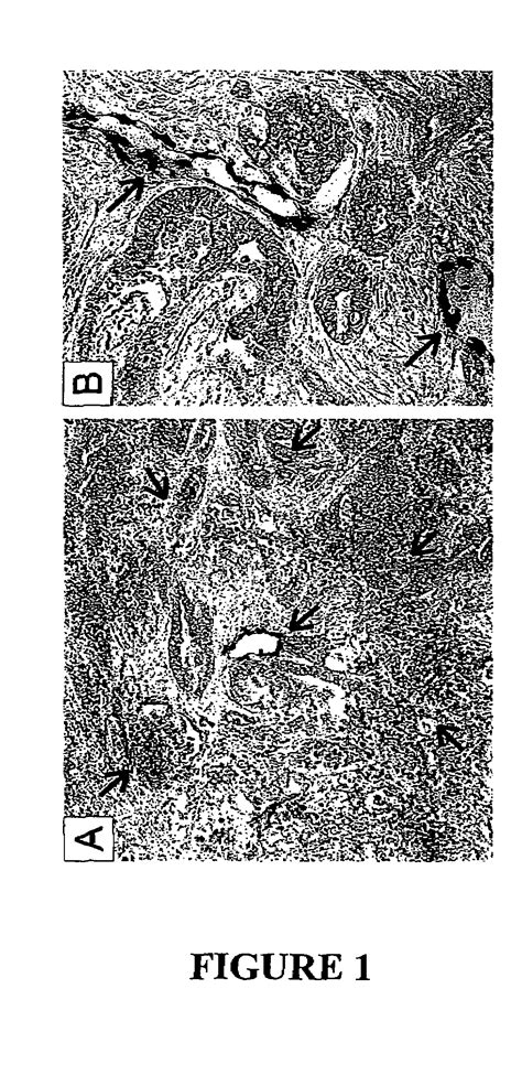 Endothelial Cell Expression Patterns Eureka Patsnap