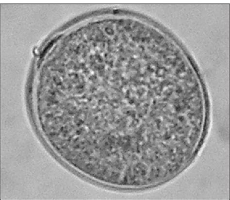 Poaceae Pollen Grain As Observed Under Light Micro Scope Download