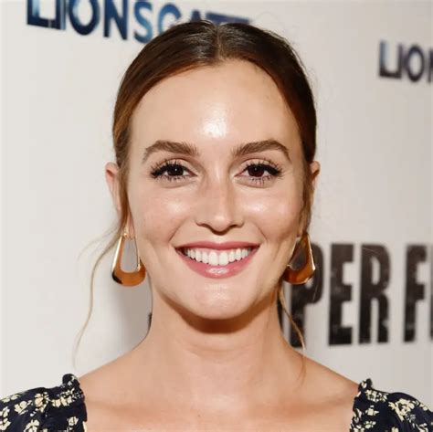 Leighton Meesterın Yeni Dişlerinin Dönüşümü Lema Dental Clinic
