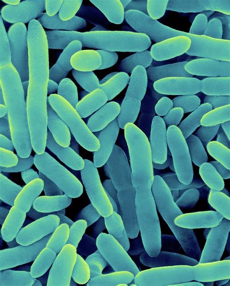 Nitrobacter Sp Bacteria Tem Photograph By Pasieka