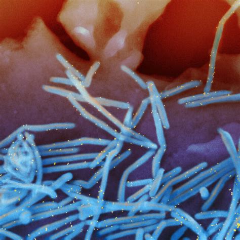 Common Cold Virus Microscope