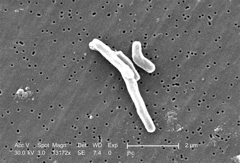 Free Picture Enlarged Ralstonia Mannitolilytica Bacteria Harvested Pure Culture