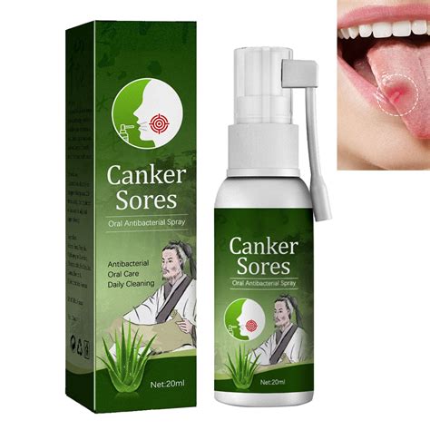 Buy Oral Ulcer Sprayprotect Teeth And Gumscanker Sore Sprayoral Ulcer